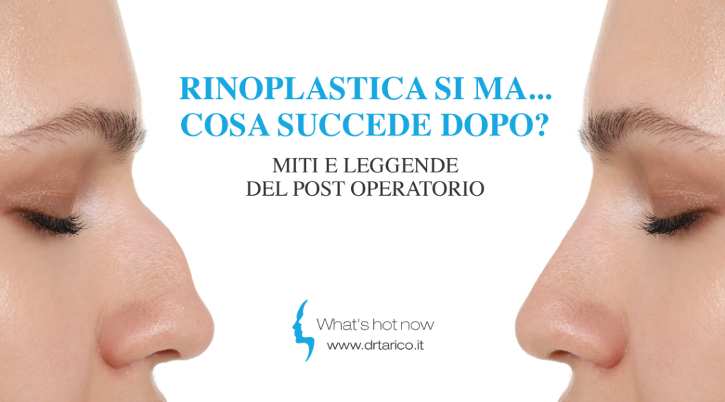 Rinoplastica sì ma... cosa succede dopo? | Chirurgia Plastica - Catania ...