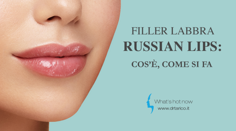 Filler labbra Russian Lips: cos'è, come si fa | Chirurgia Plastica ...